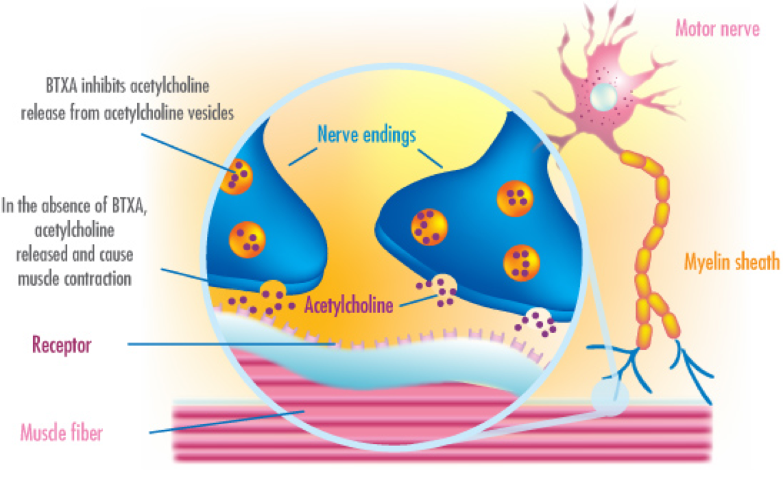 Injection Therapies – MDS DOCS